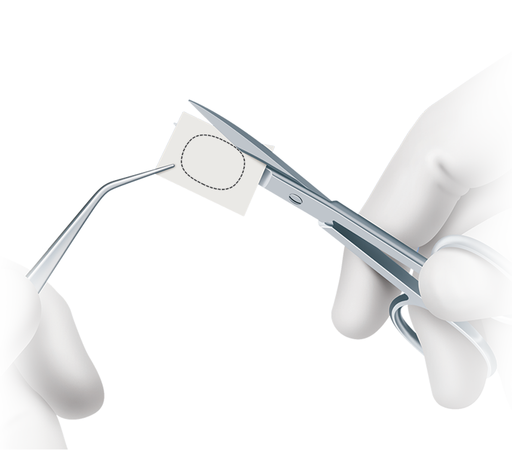 BioMend® and Biomend Extend™ Membrane | Zimvie Dental Biomaterial Solutions